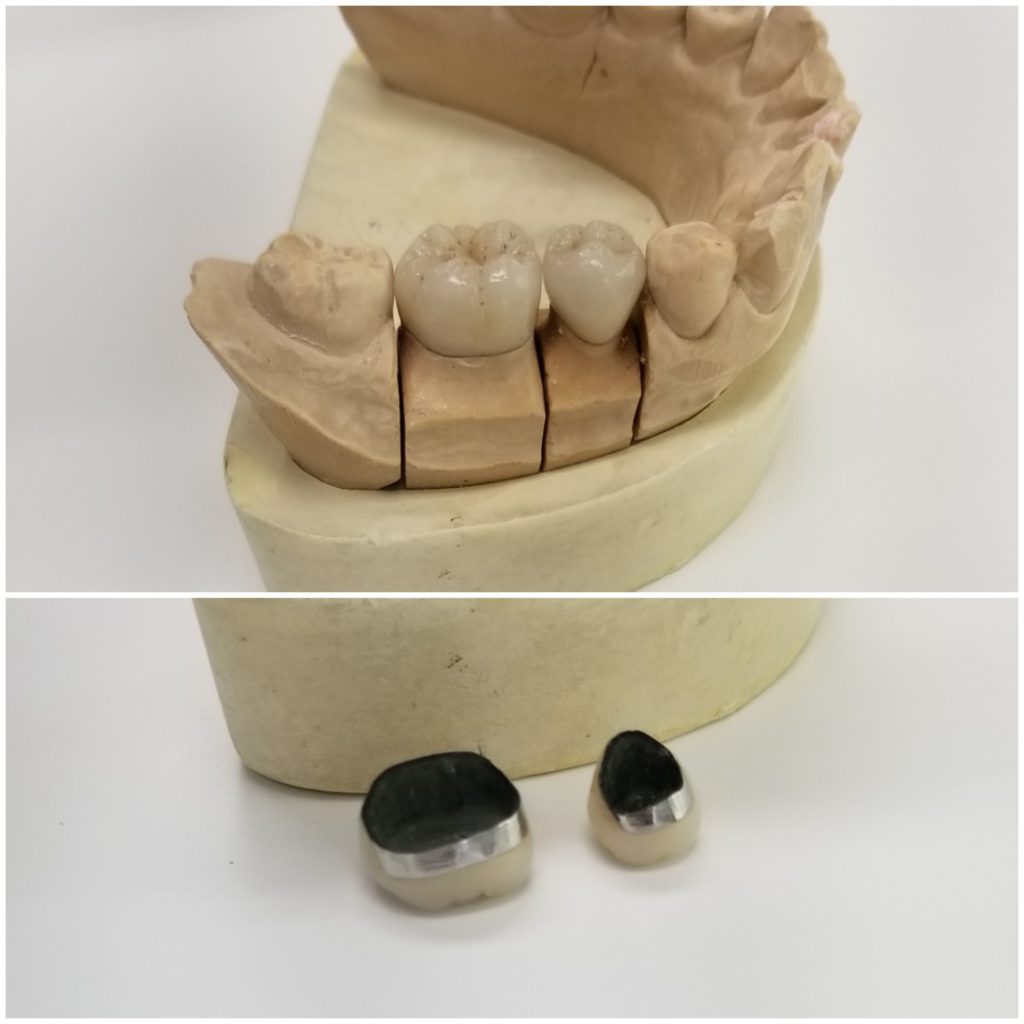 yougo_metabon | 学芸大歯科・歯医者≪井上歯科クリニック 学芸大学≫目黒区学芸大学予防歯科・小児歯科・歯科医院